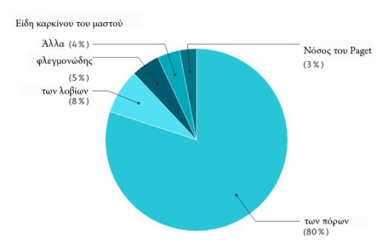 Διηθητικός καρκίνος μαστού | Dr Παπαδόπουλος Σ. Χειρουργός Μαστολόγος